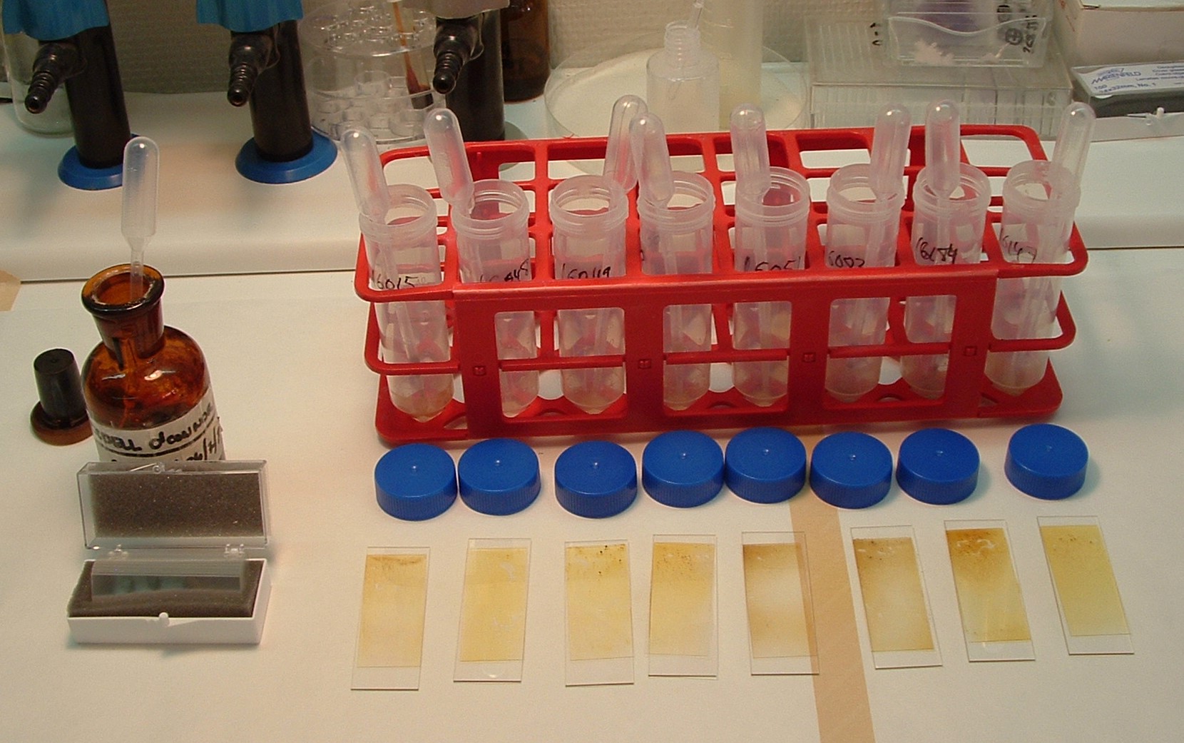 TÉCNICAS PARASITOLÓGICAS – SOCALEMI